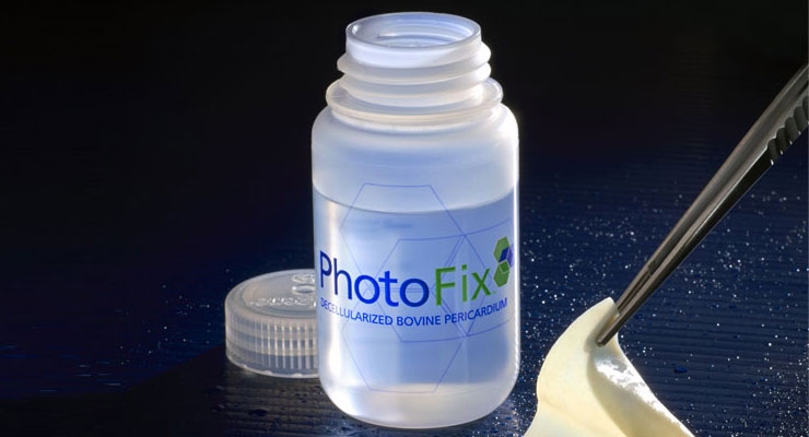 CryoLife Buys Bovine Pericardium Patch from Genesee Biomedical ...
