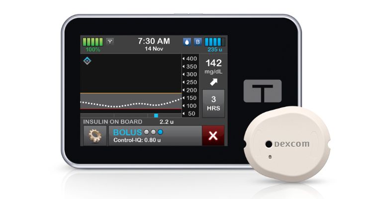 Tandem Diabetes Rolls Out t:slim X2 Insulin Pump Software for Dexcom G7 ...