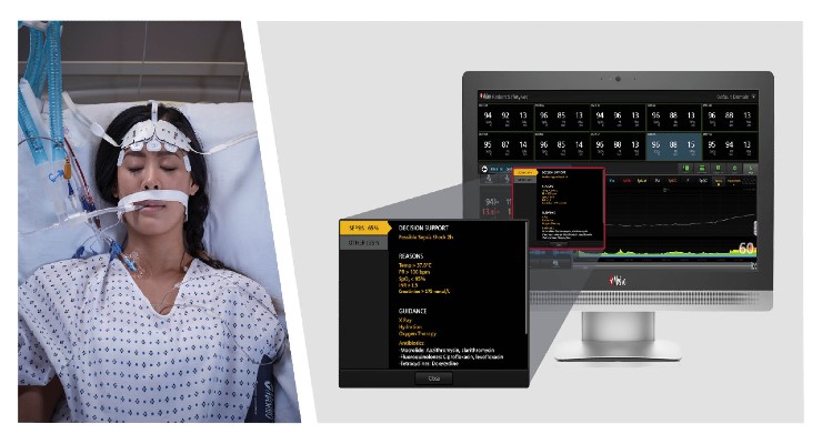 Masimo Launches Sepsis Index in Limited Release - Medical Product Outsourcing