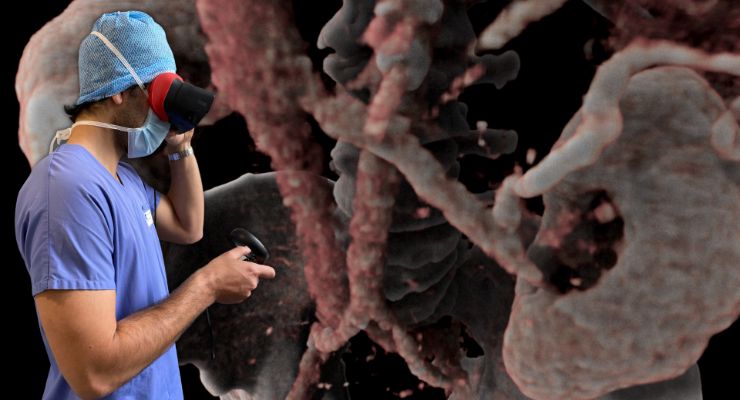 FDA OKs Avatar Medical's VR Surgical Planning Tool - Medical Product Outsourcing