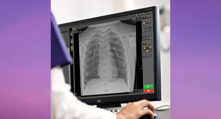 Carestream Unveils Solution for Improved CR, DR Imaging Systems ...