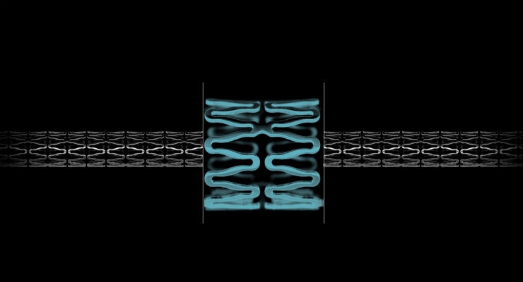 FDA Approves CeloNova Biosciences' NanoCoated Stent System - Medical ...