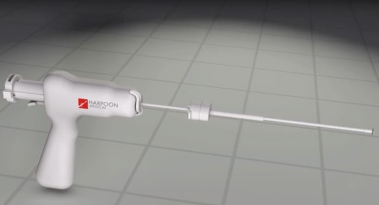 First Three Patients Enrolled in Harpoon Medical MR Clinical Study ...