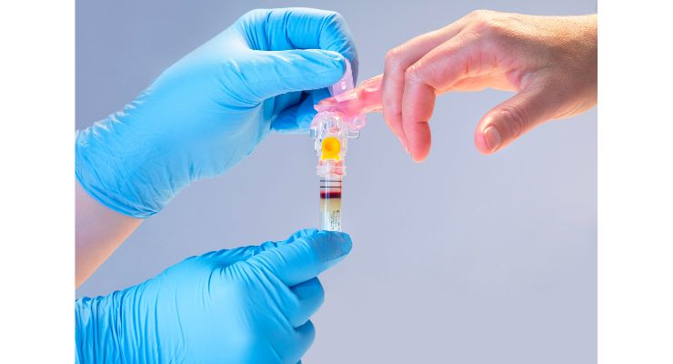 BD Receives FDA 510(k) Clearances for Fingertip Blood Collection System ...