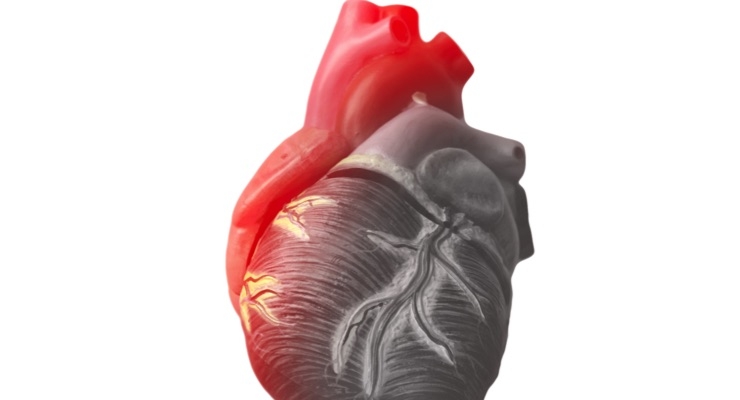 VisCardia Completes $12.5 Million Series B Financing and Assets ...