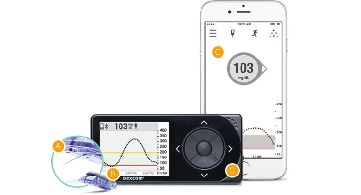 Dexcom G5 Mobile CGM Awarded Expanded Indication to Replace Fingerstick ...