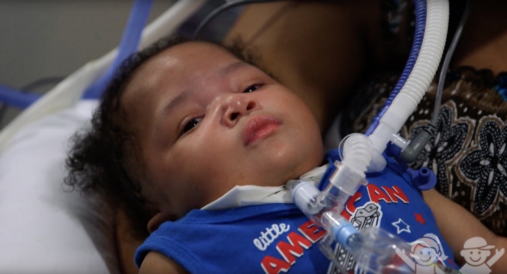 3D-Printed Tracheal Splints Used in Groundbreaking Pediatric Surgery ...