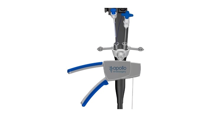 Apollo Endosurgery, Italian Institute Establish European Registry for ...