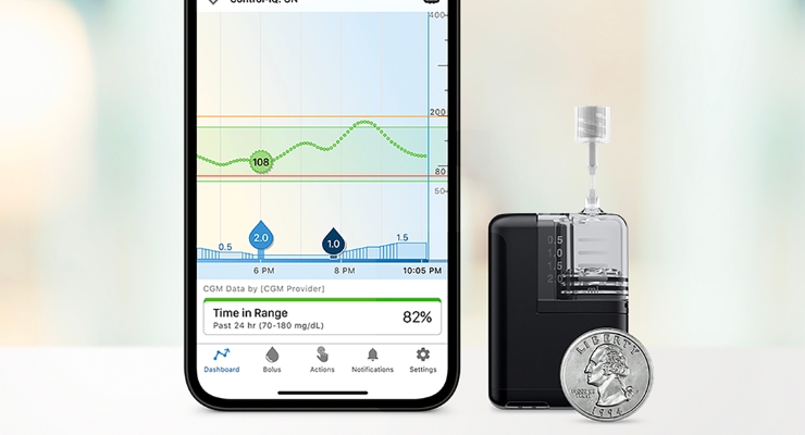 Tandem Diabetes Rolls Out Mobi Automated Insulin Pump in U.S. - Medical ...