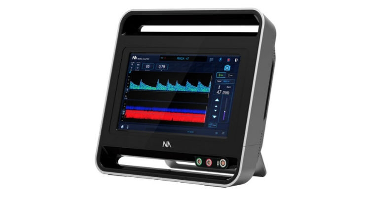 Portable Transcranial Doppler Technology Accurately Measures Early ...