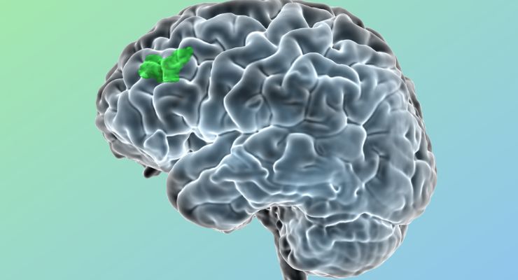 Magnus Medical Begins SAINT Neuromodulation Trial for Major Depression ...