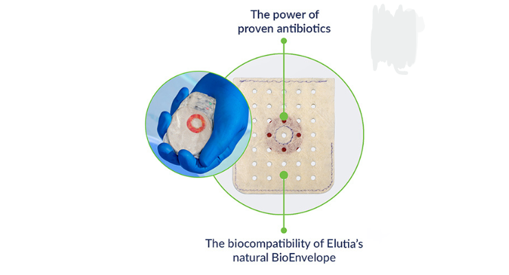 Elutia Wins FDA Clearance of its Antibiotic-Eluting BioEnvelope ...