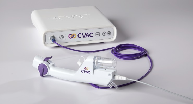 Calyxo Announces New ASPIRE 1-Year Study Results - Medical Product ...