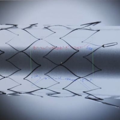 Nitinol in Medtech: History, Capabilities, and Advancements - Medical ...