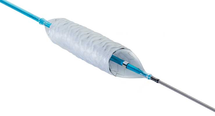 Free Flow: A Look at the Current State of Stents - Medical Product ...