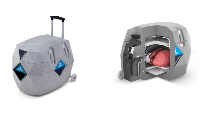 Paragonix Has 1st Pediatric Use of BAROguard Donor Lung System ...