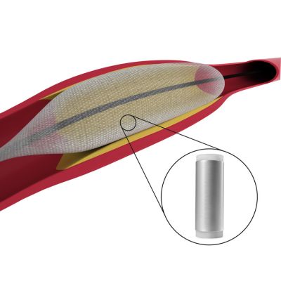 Facilitating Lighter, Stronger, and Durable Medical Devices