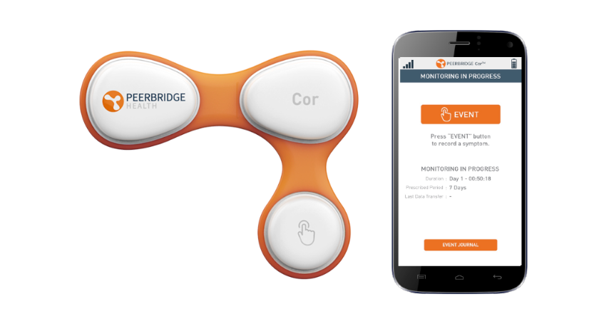 Peerbridge Kicks Off Ambulatory ECG Wearables Trial | Medical Product ...