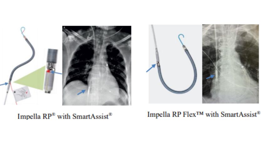 J&J's Abiomed Updates Impella RP Instructions in Class I Recall