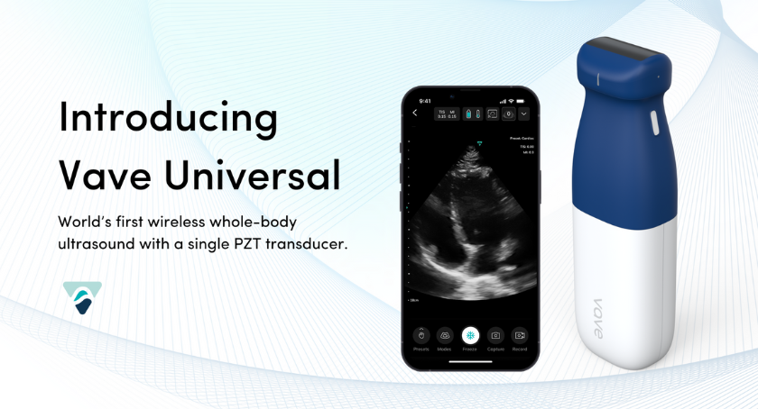 World’s First Wireless, Handheld Whole-Body Ultrasound Unveiled ...