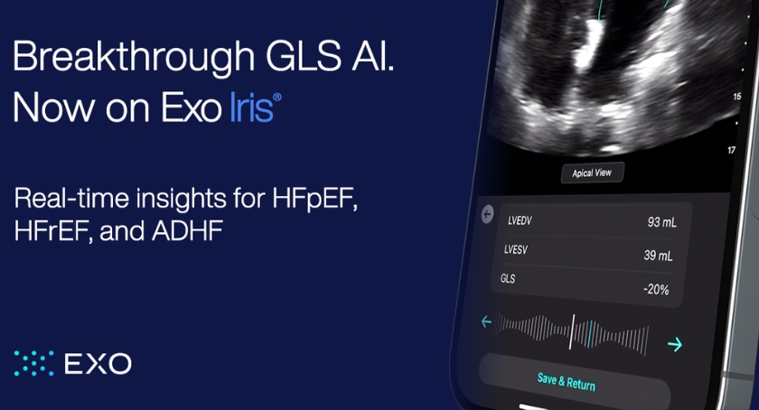 Exo Wins FDA Nod for AI Indicator for HFpEF and Cardiotoxicity