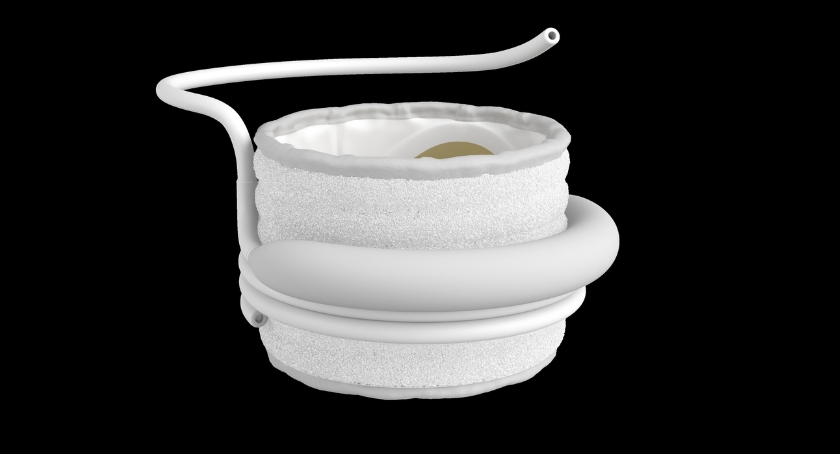 Edwards Wins EU Nod for Sapien M3