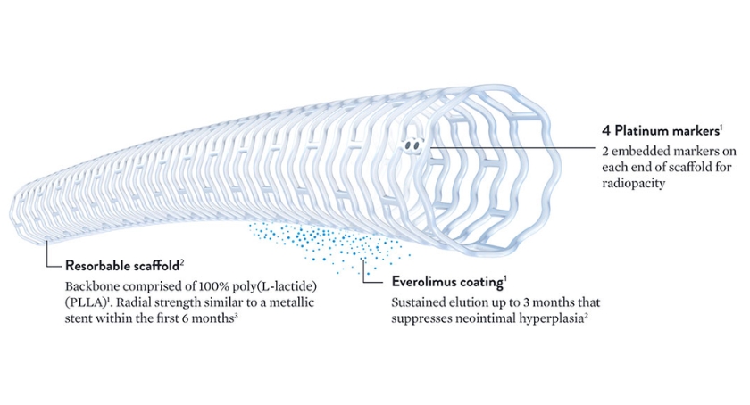 Abbott's Esprit BTK Dissolving Stent Earns CE Mark