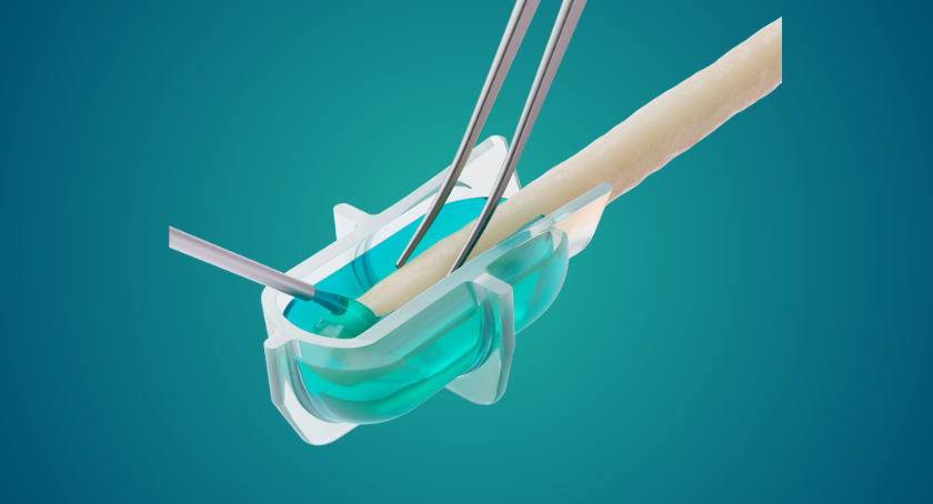 Tulavi, VHSS Team Up on Surgical Nerve Treatment for VA Amputees ...