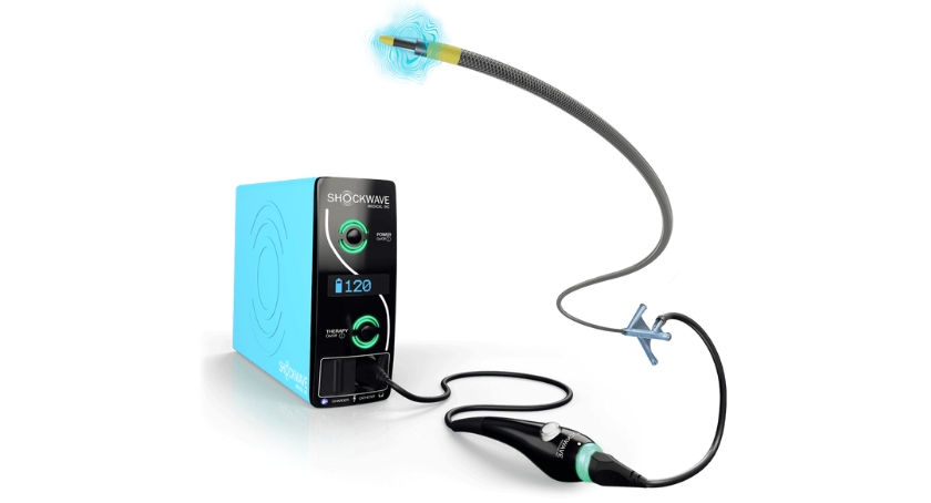 Johnson & Johnson MedTech Data Backs Shockwave Javelin IVL