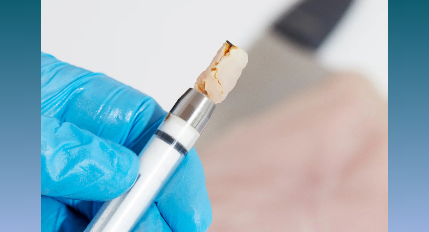 FDA Clears Resitu Medical's Breast Biopsy Device - Medical Product ...