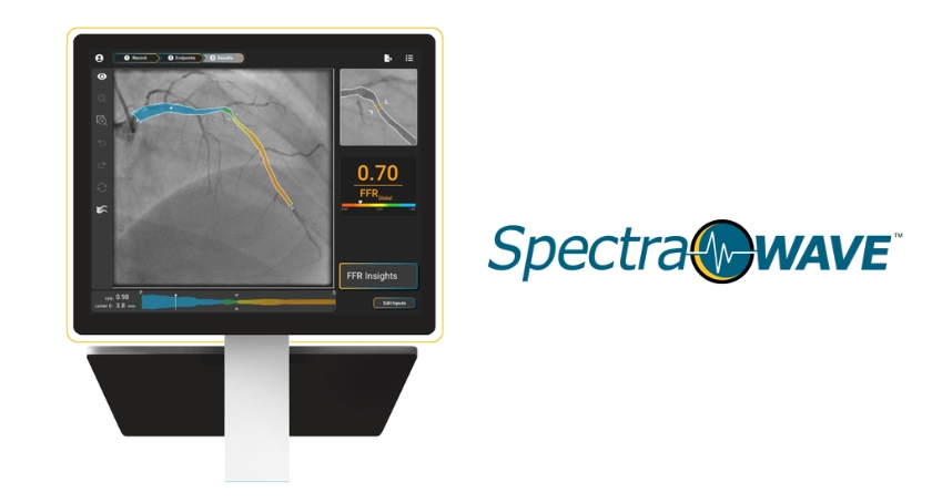 FDA OKs AI-Powered Angiogram Physiology Software