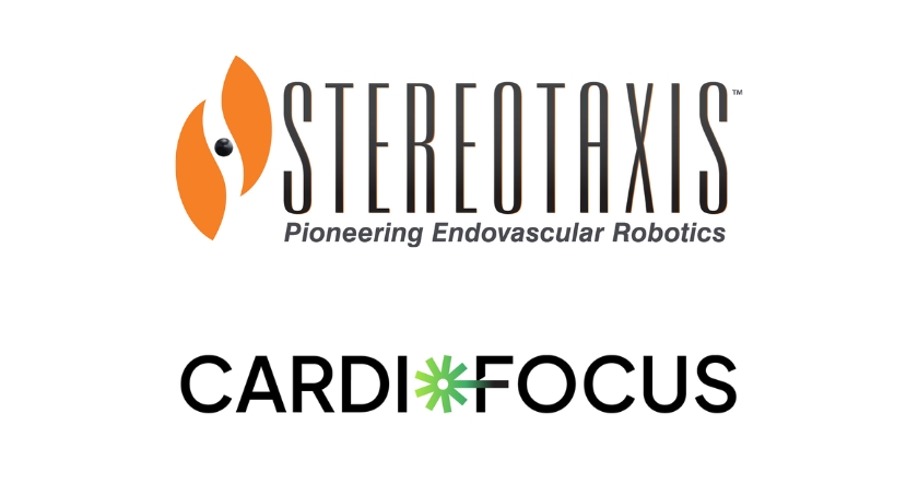 Stereotaxis, CardioFocus Collab to Advance Robotic PFA
