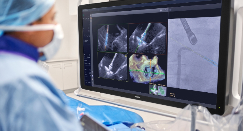 Philips Reveals AI-Powered Device Tracking for TEER Procedures