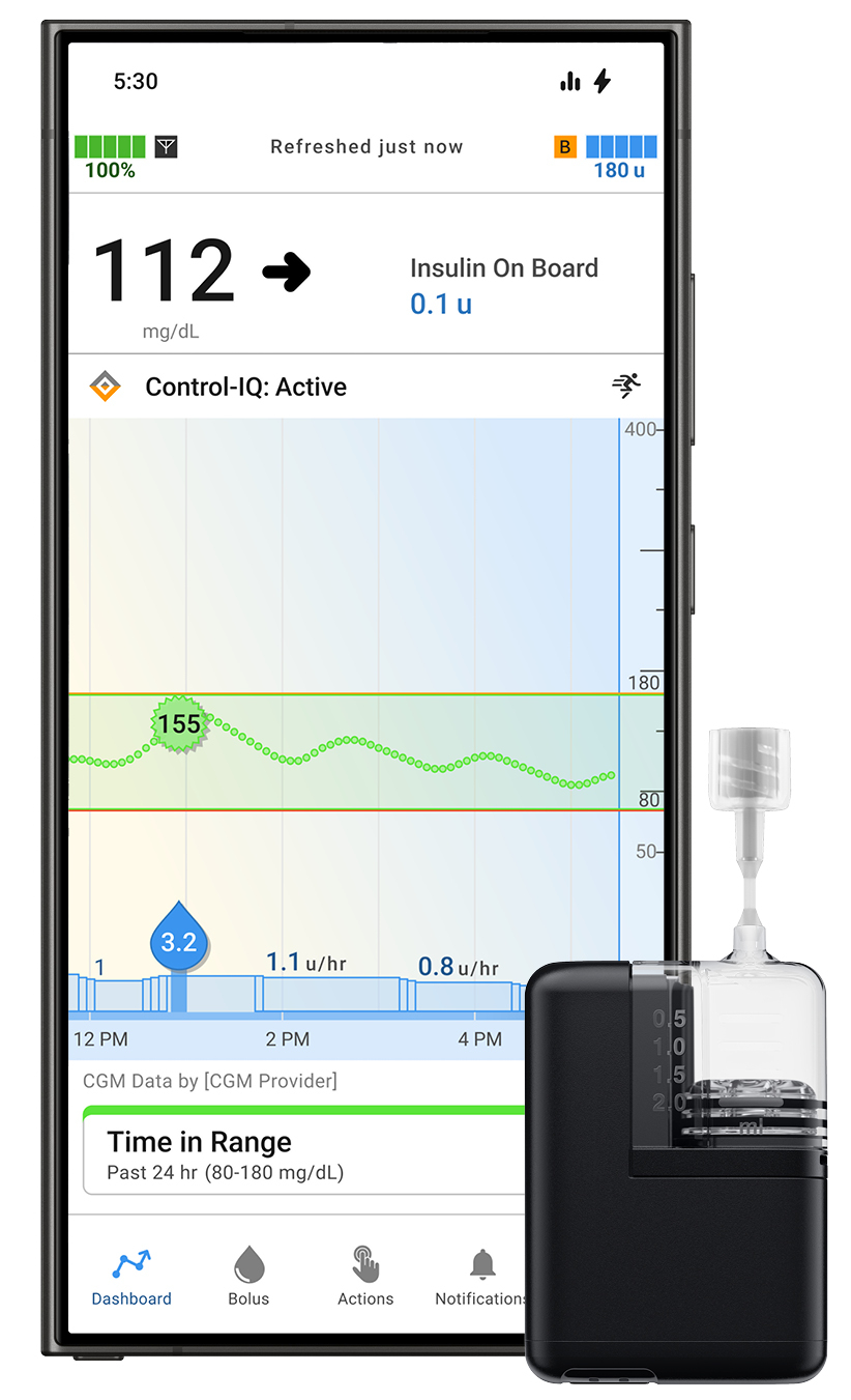 Tandem Mobi Insulin Pump Wins FDA Nod for Android