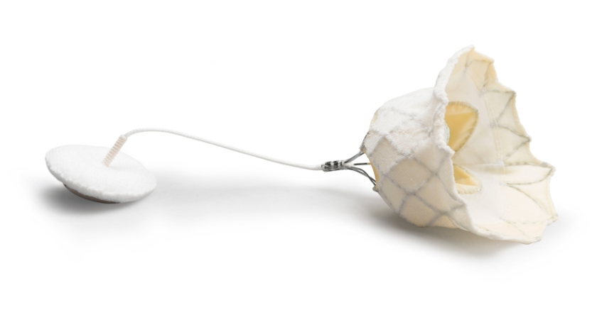 Trial Leader Weighs In on Abbott’s Tendyne TMVR