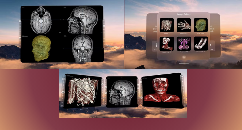 Medical iSight Unveils XRAIview for Apple Vision Pro - Medical Product ...