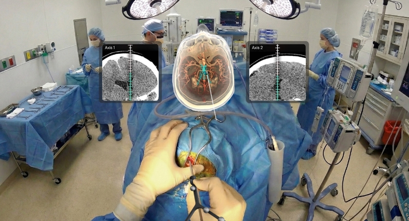 Medivis Wins FDA Nod for AR Cranial Navigation Platform