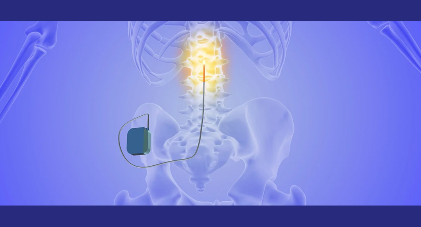 Lubrizol Unveils New Implantable Medical-Grade Material - Medical ...